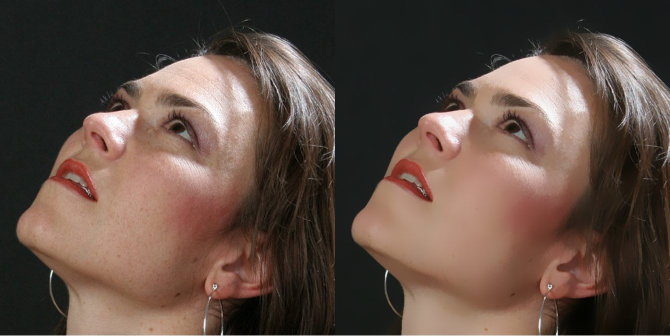 Surface Blur And Median Surface Blur And Median